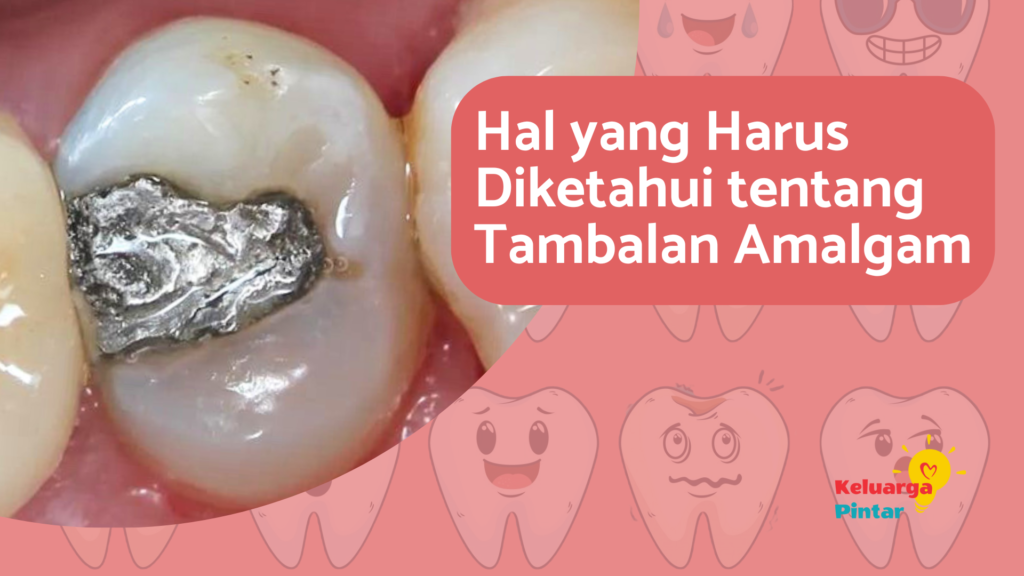 Hal yang Perlu Anda Tahu Tentang Tambalan Amalgam - Keluarga Pintar ...